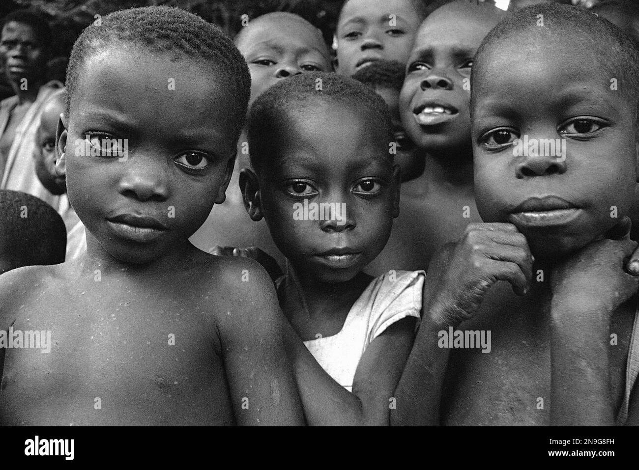 A group of starving Biafran children wait at Aba for doctors to see ...