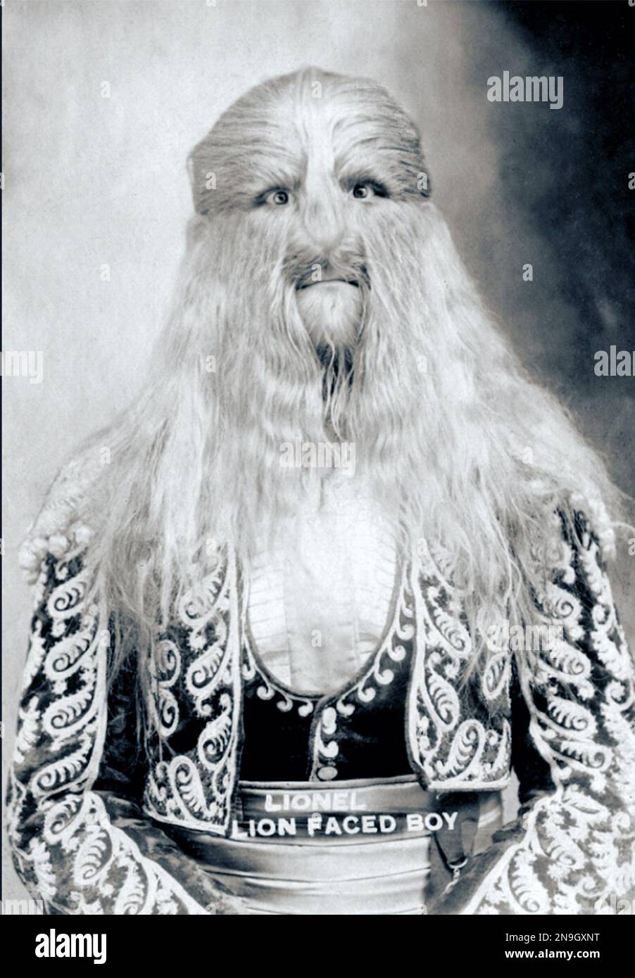 Lionel the lion faced man hi-res stock photography and images - Alamy