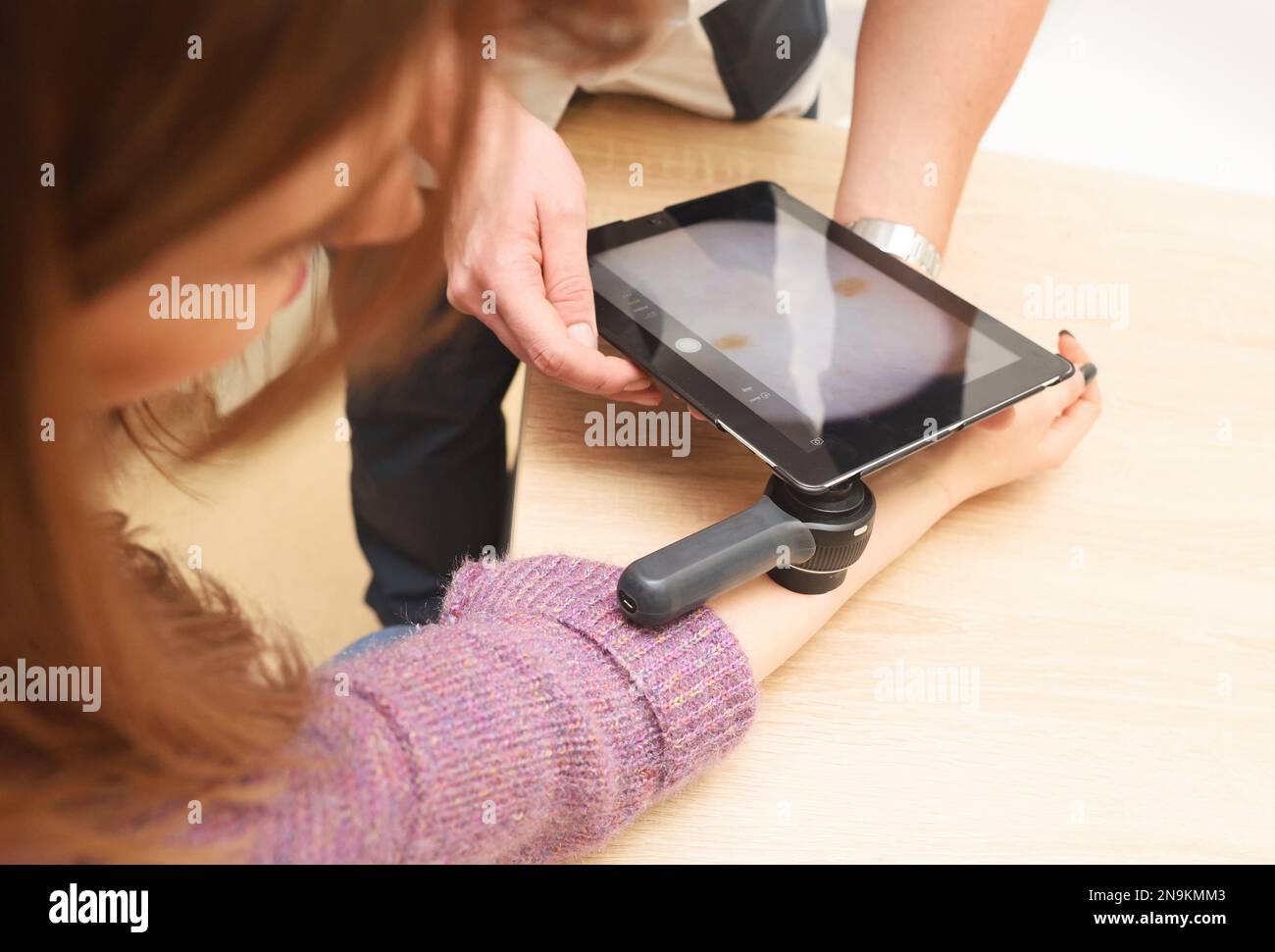 dermatologist examines moles on a female patient's arm with a ...