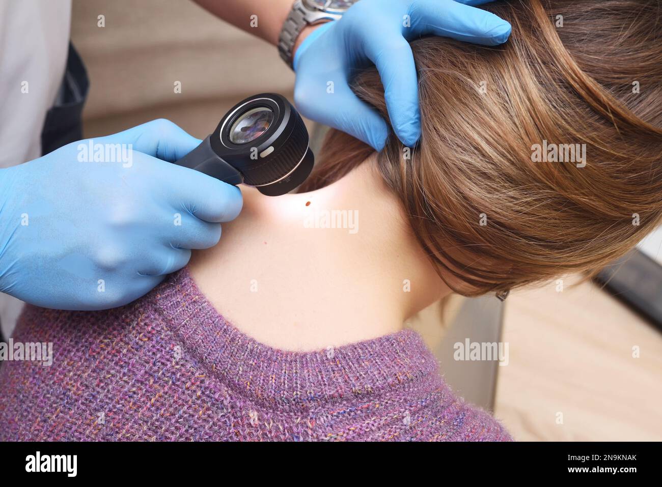 dermatologist examines a mole on the patient's neck using a special ...