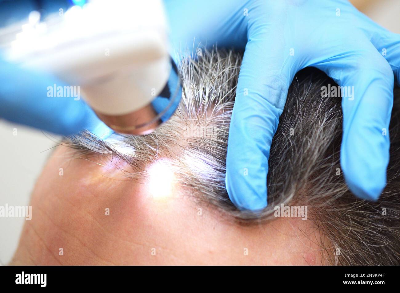 A cosmetologist-trichologist diagnoses the condition of a male patient ...