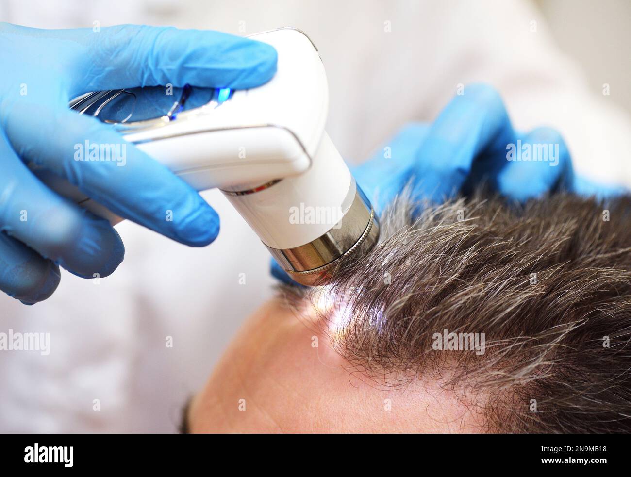 A cosmetologist-trichologist diagnoses the condition of a male patient ...