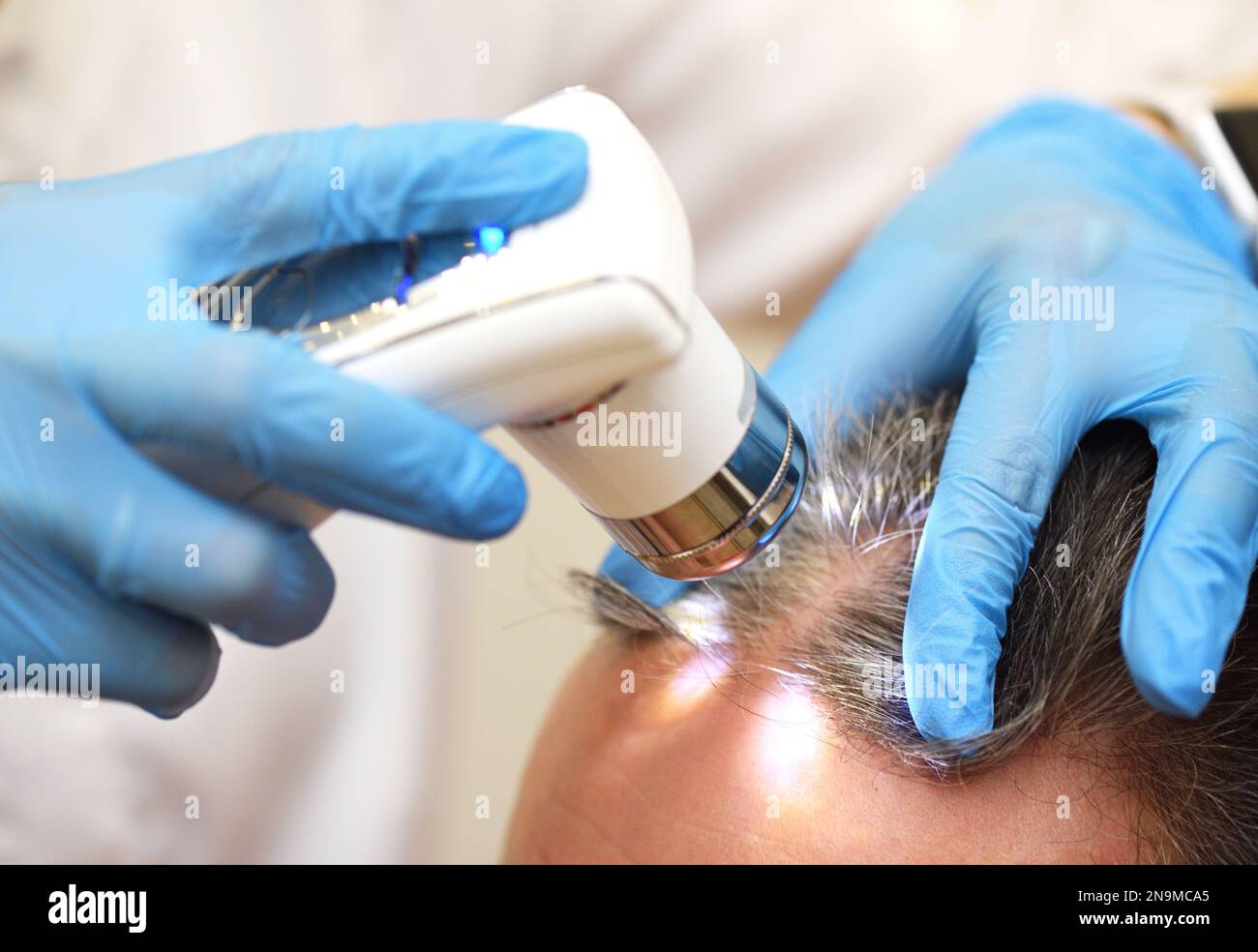 A cosmetologist-trichologist diagnoses the condition of a male patient ...