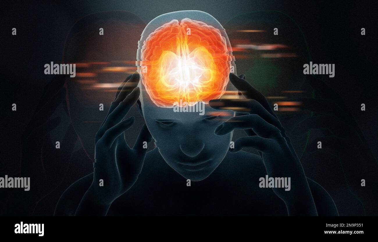 Man suffering from brain pain, headache or mental health disorder 3D ...