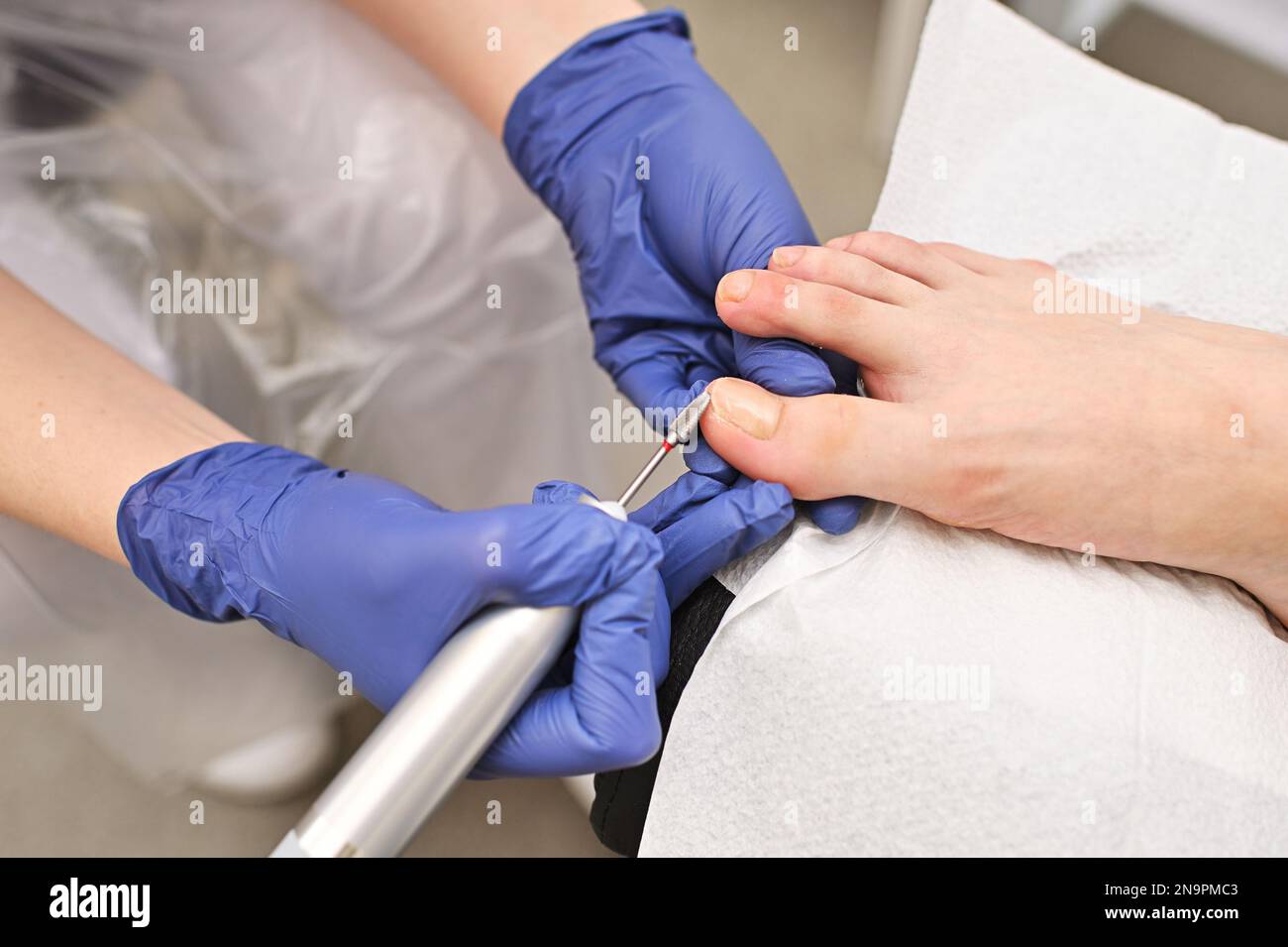 Hardware medical pedicure with a drill and nail files. A patient on a ...