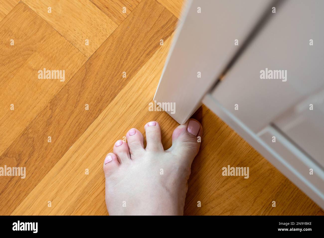 Woman hit furniture with big toe. Incident at home. Injury of foot ...