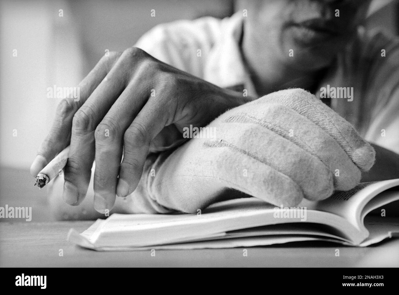 A gloved prosthetic hand in Vietnam in an undated photo. This is part ...