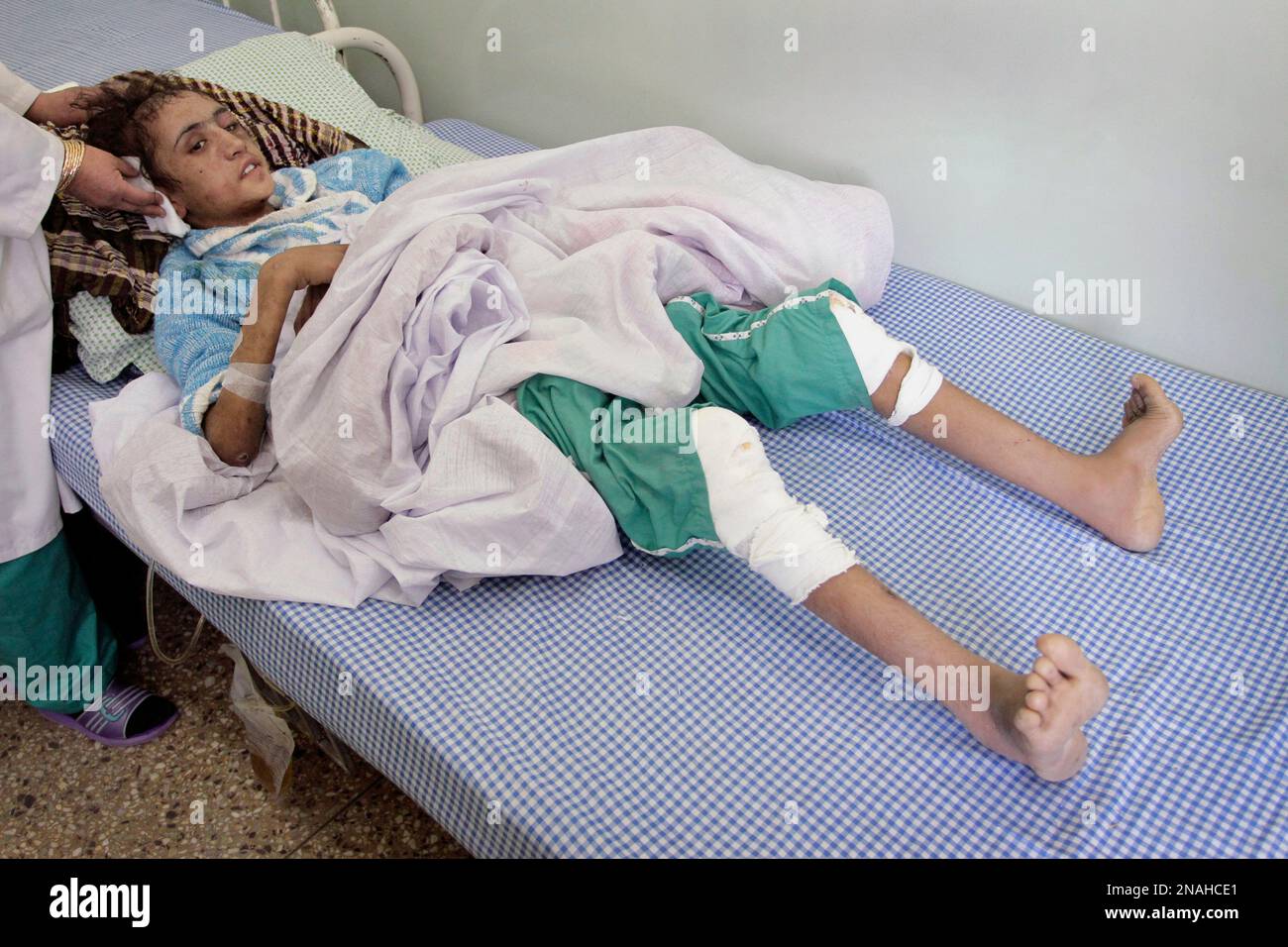 Fifteen year-old Sahar Gul, is treated as she rests on a bed at a ...