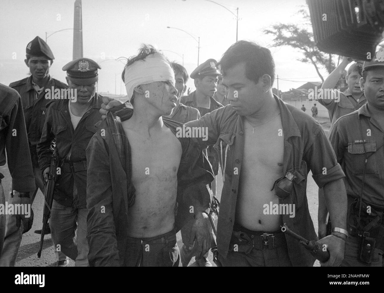 A Vietcong with head wounds after he was captured by South Vietnamese ...