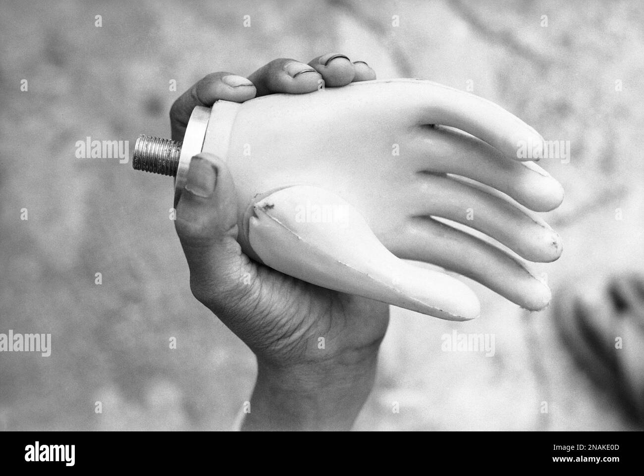 This hand belongs to its holder a 13-year-old boy who lost his arm when ...