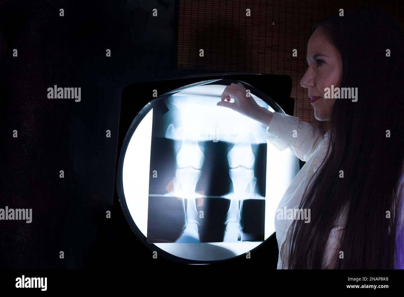 Doctor reviews radiographic study of patellar area reviewing patient's ...