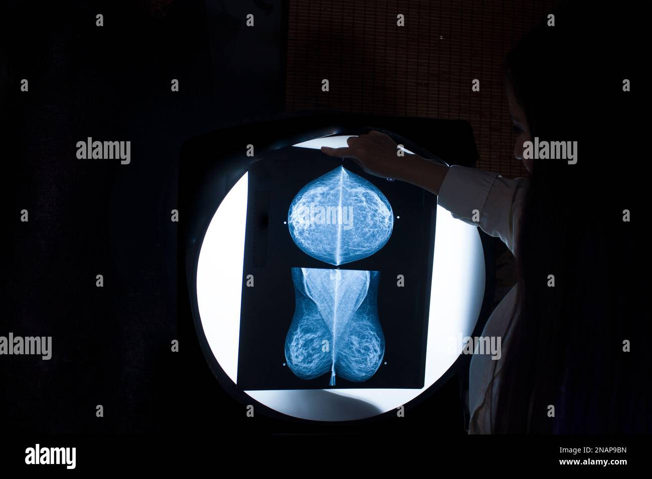 Female Doctor with specialty in Gynecology analyzes x-rays of patient's ...