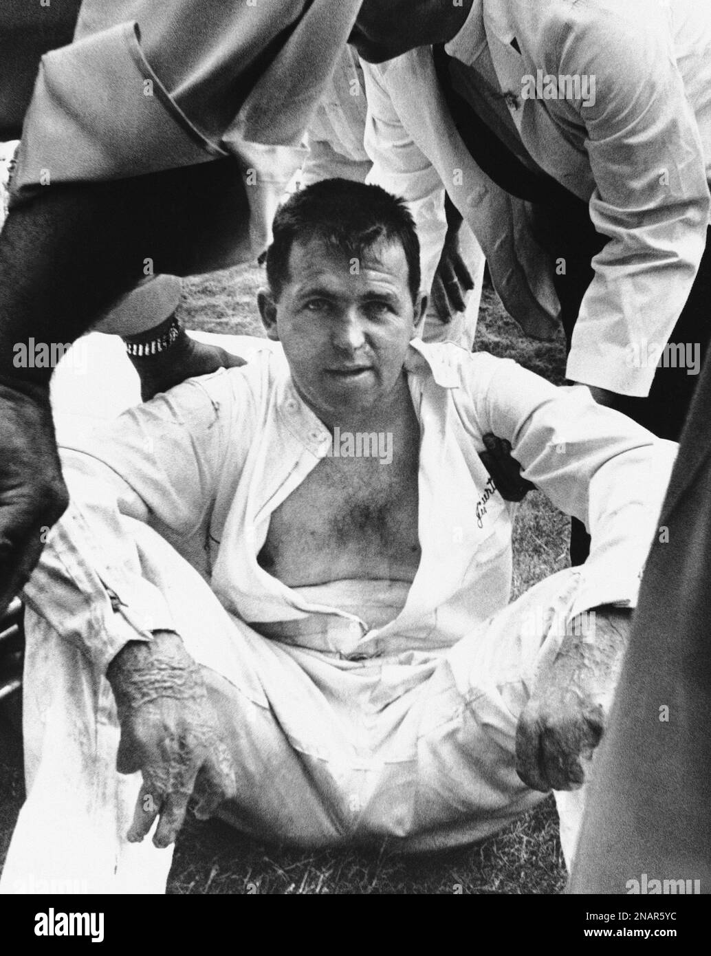 Race Driver Jim Hurtubise of North Tonawanda, New York, sits dazed on ...