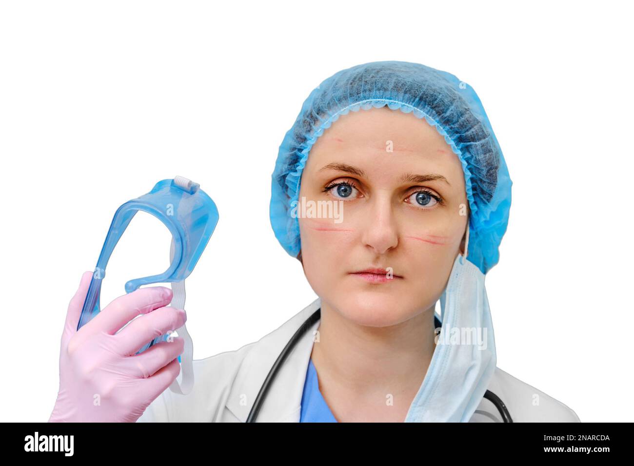 A doctor with a wounded face removes goggles after working in the ...