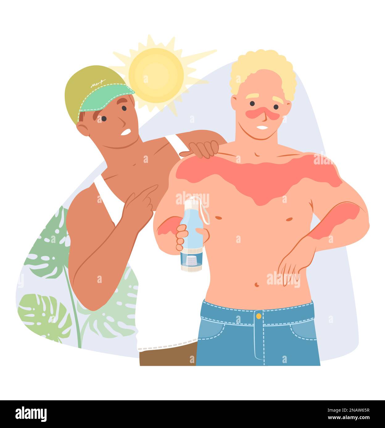 Friend Helping Man With Sunburned Skin Vector Stock Vector Image And Art