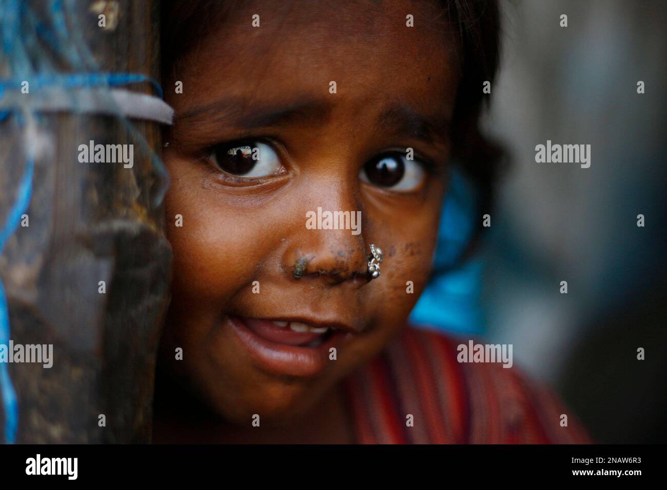 An impoverished Nepalese girl reacts to camera at a slum in Katmandu ...