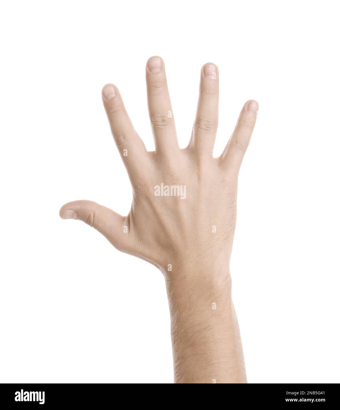 Man showing pale hand on white background, closeup. Anemia symptom ...