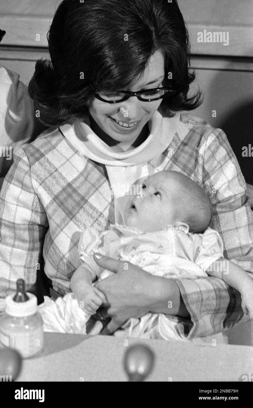 Patricia Durbin, survivor of Siamese twins who were separated on March ...