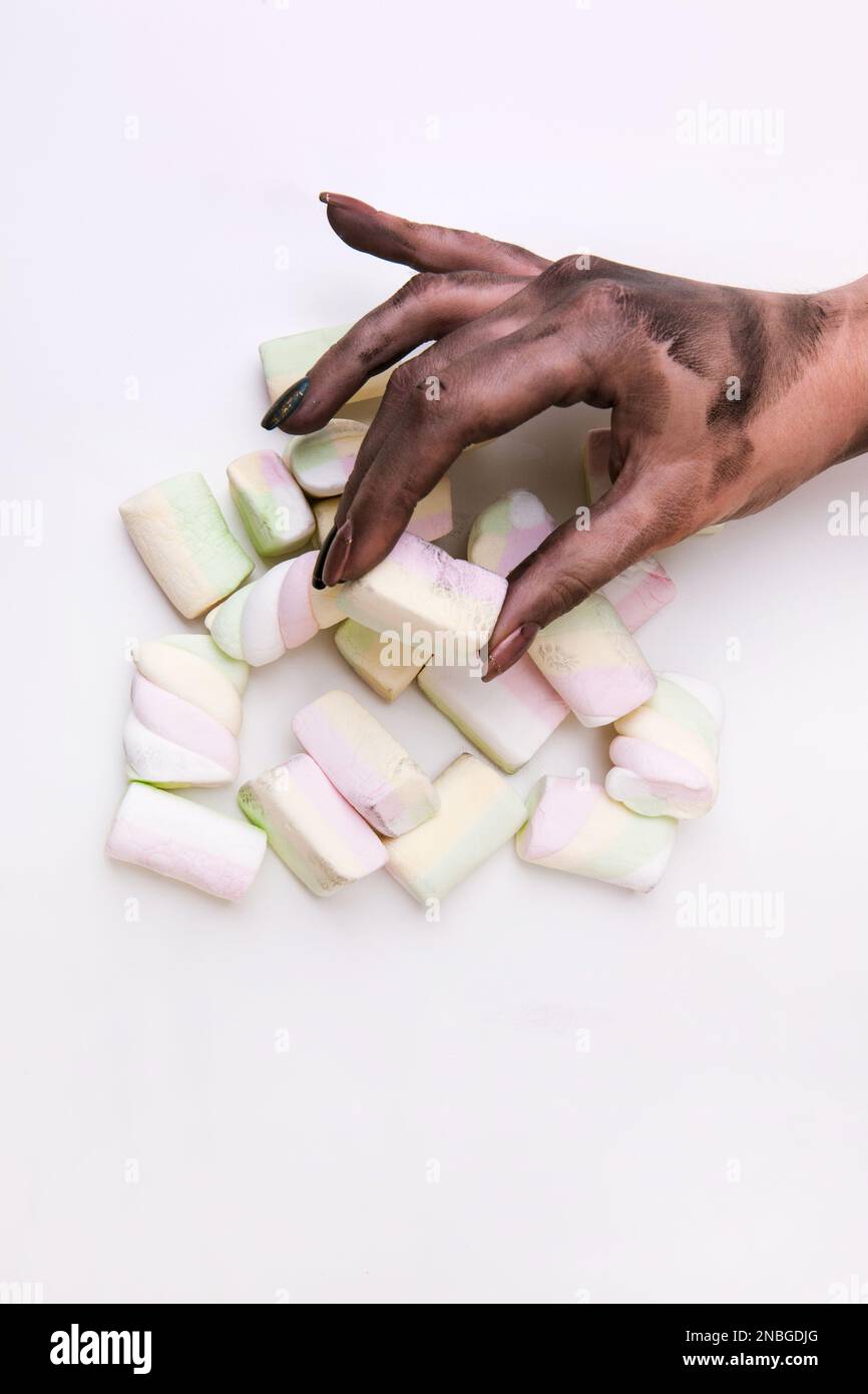 food poisoning dirty hand hygiene germs poverty Stock Photo - Alamy