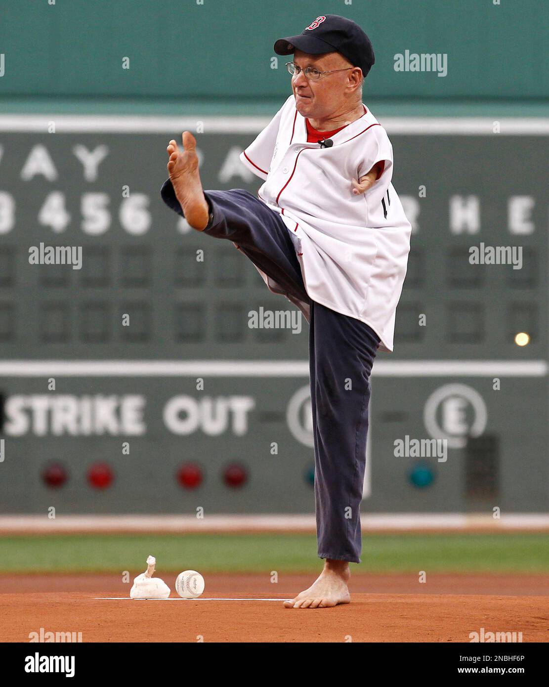 Tom Willis, who was born without arms and hand, follows through after ...