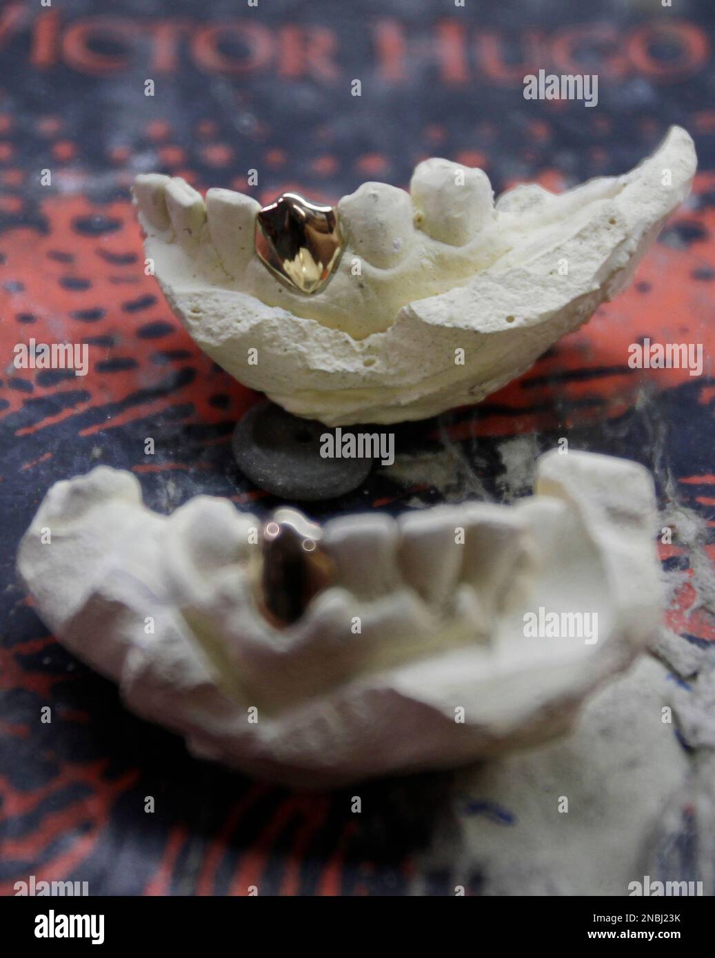 In this June 20, 2011 photo, a golden tooth sits on a mold at the ...