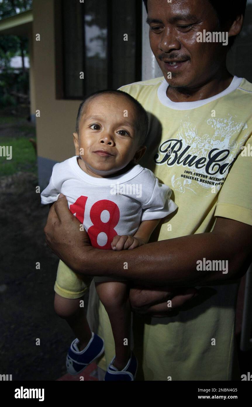 Junrey Balawing is cuddled by his father Reynaldo after being measured ...