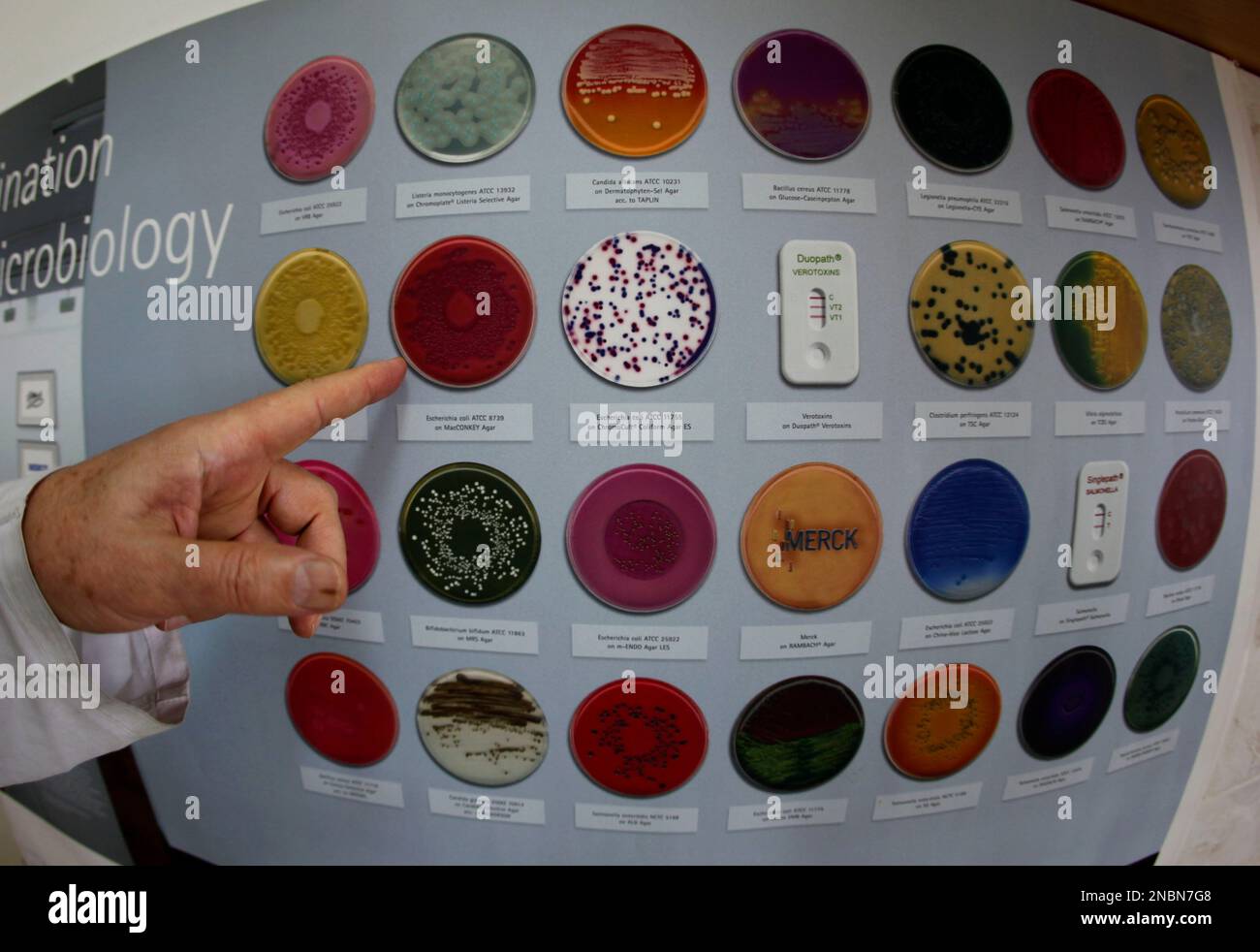 A lab specialist points out examples of a bacterial growth including ...