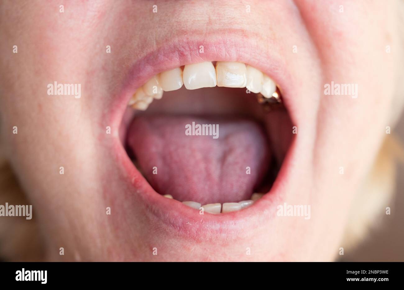Close-up photo of natural looking teeth of a aged woman Stock Photo - Alamy