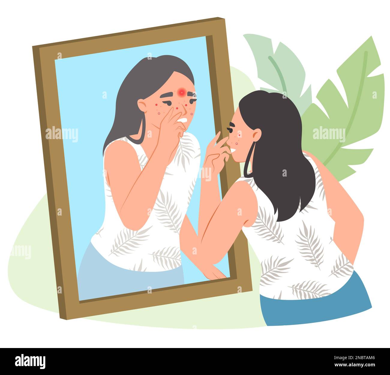 Girl With Acne Skin Problem Vector Illustration Stock Vector Image