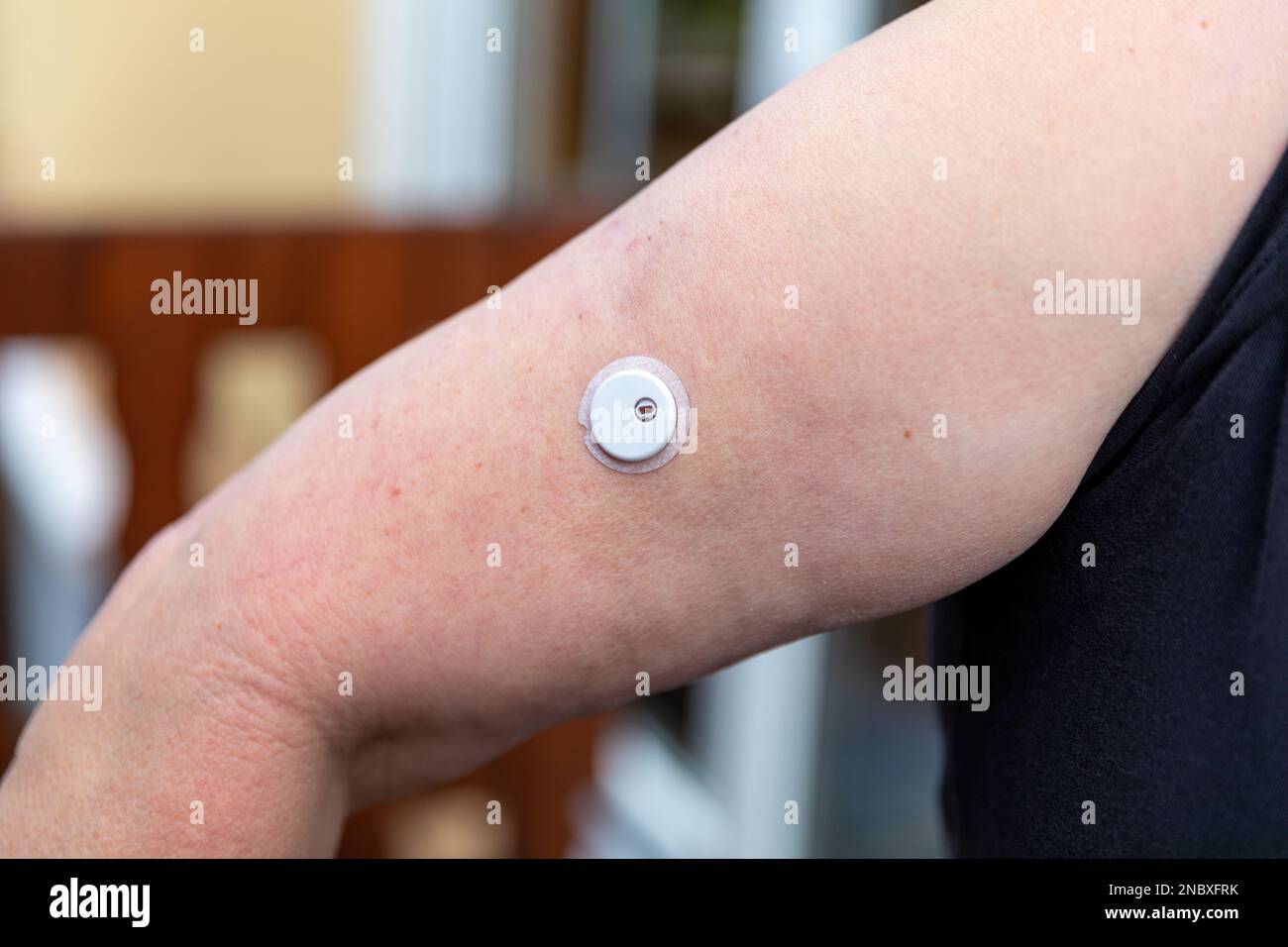 Glucose sensor device hi-res stock photography and images - Alamy