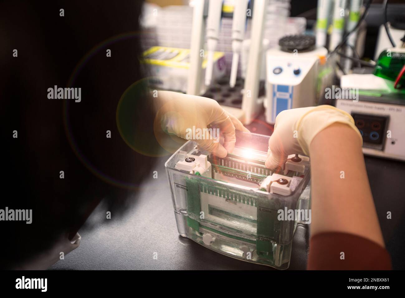 Western blot analysis use as protein analysis for protein detection ...