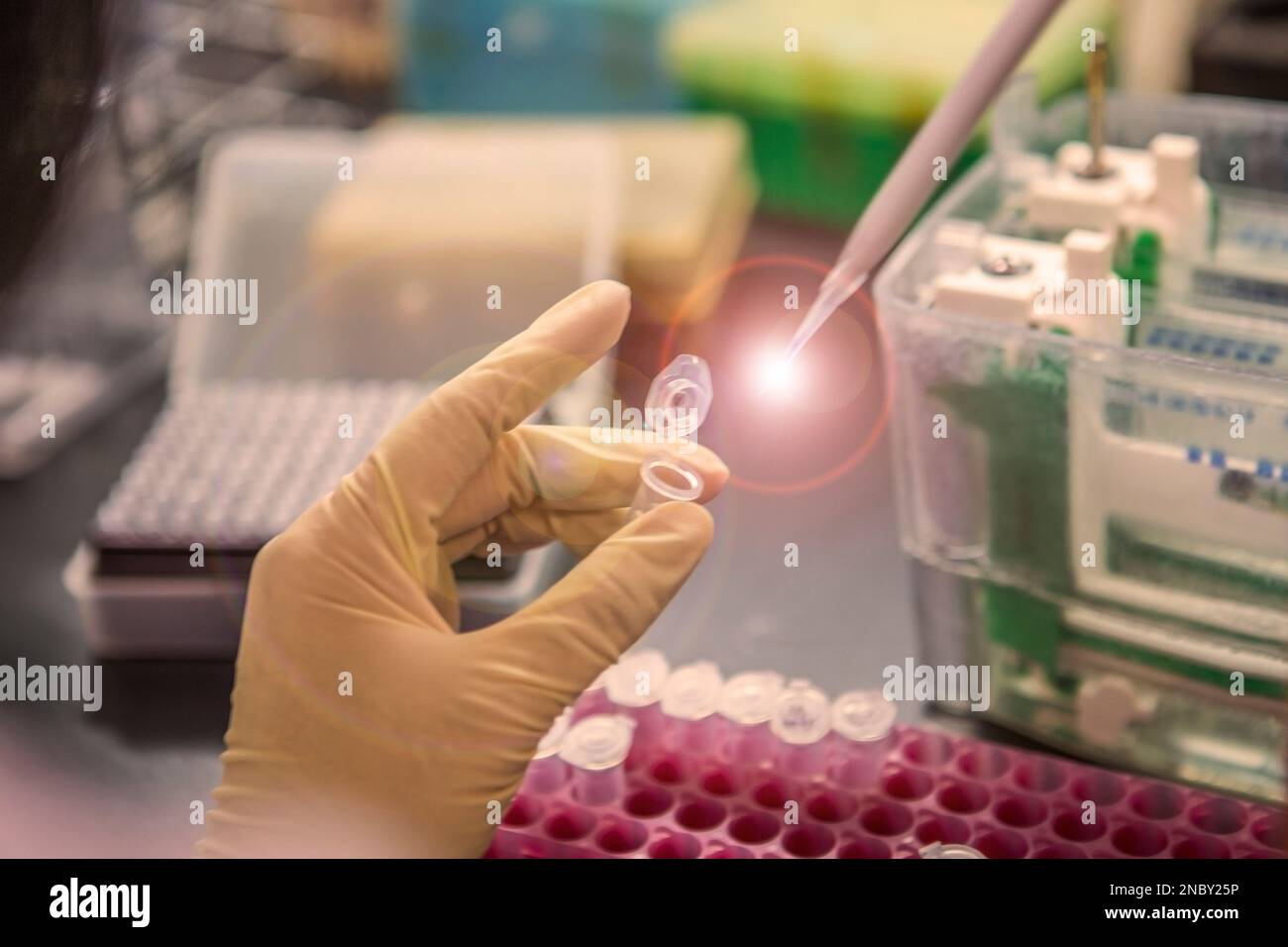 Western Blot Analysis Use As Protein Analysis For Protein Detection