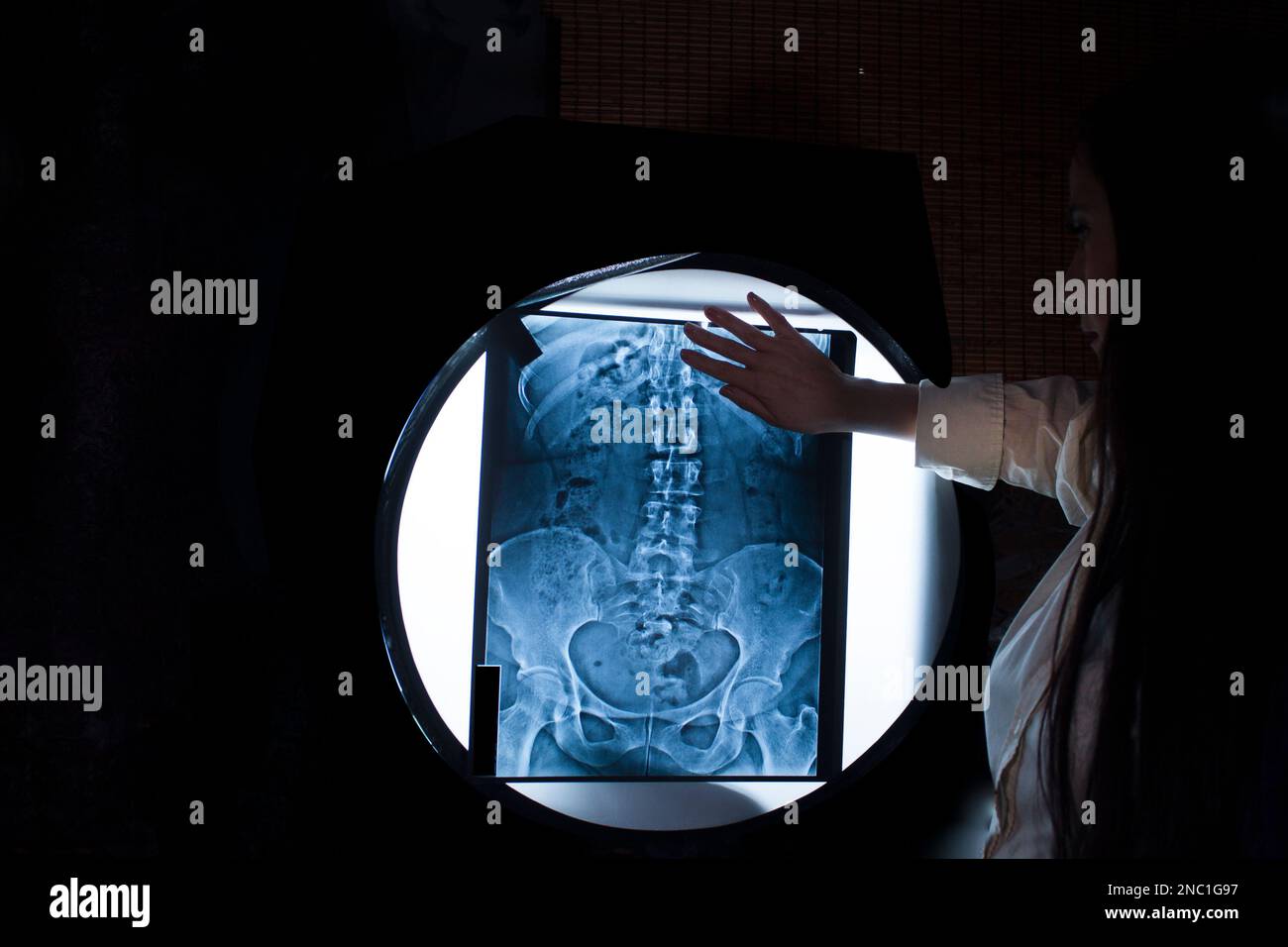 Caucasian doctor analyzes the x-rays of a patient's congenital ...