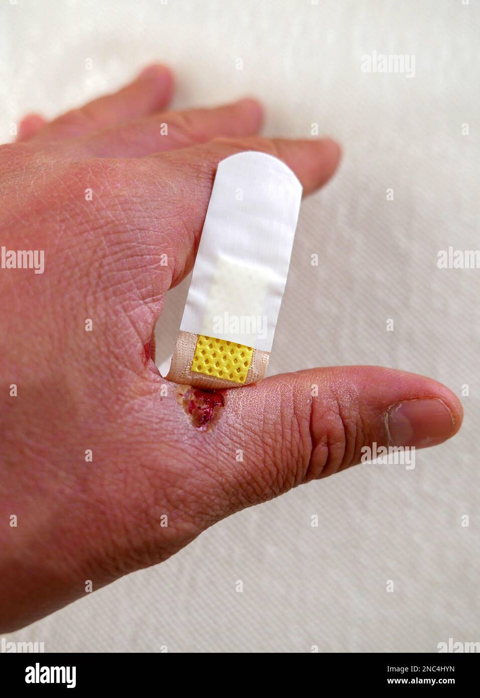 a human hand injured after a work accident, band-aid, band-aid to wrap ...
