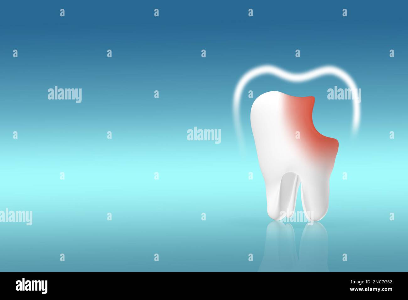 Unhealthy tooth white molar model and Protective vortex around tooth on ...