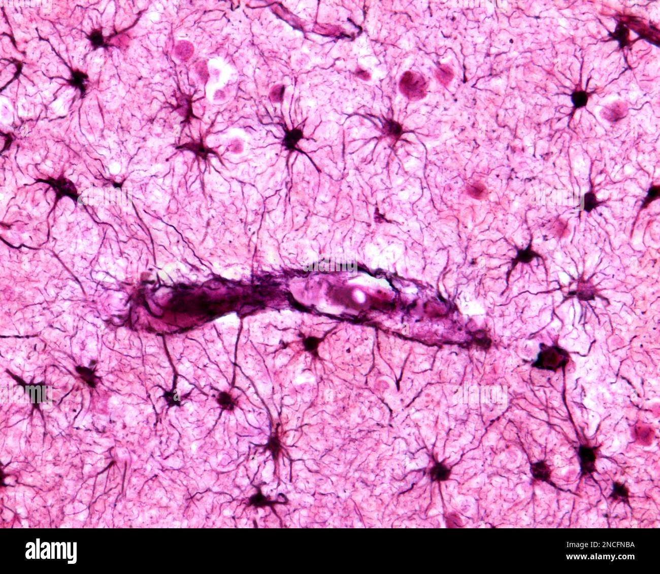 Protoplasmic astrocytes, light micrograph Stock Photo - Alamy