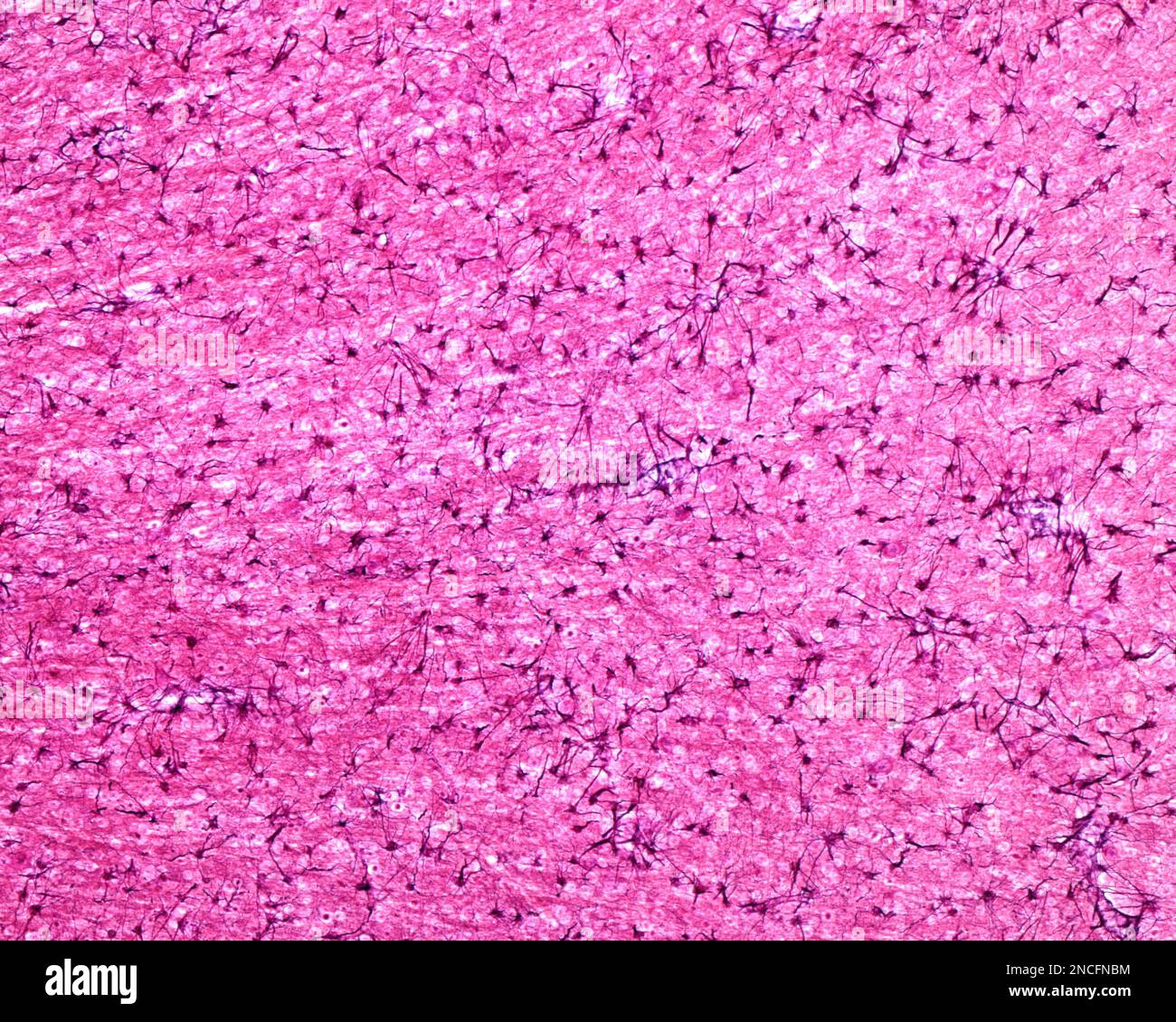 Fibrous astrocytes, light micrograph Stock Photo - Alamy