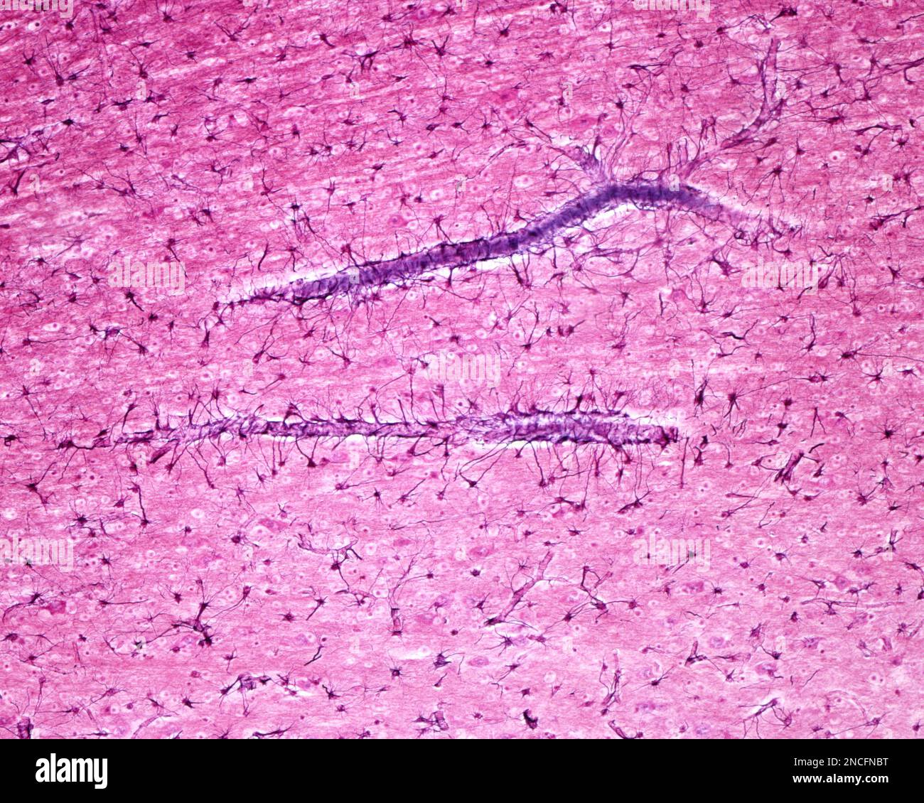 Fibrous astrocytes, light micrograph Stock Photo - Alamy