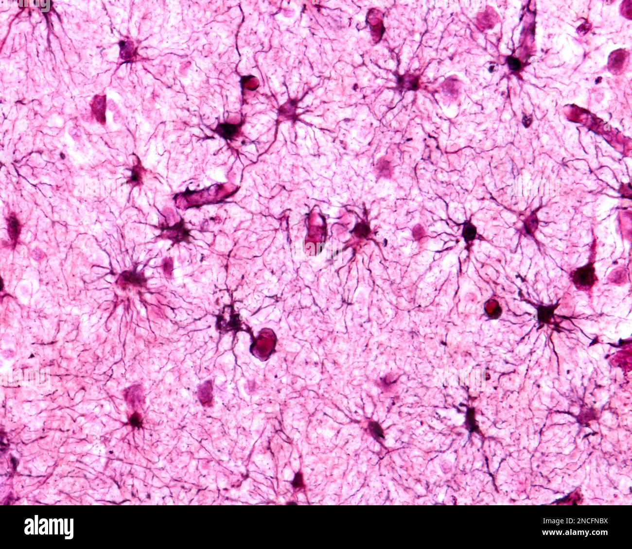 Protoplasmic astrocytes, light micrograph Stock Photo - Alamy