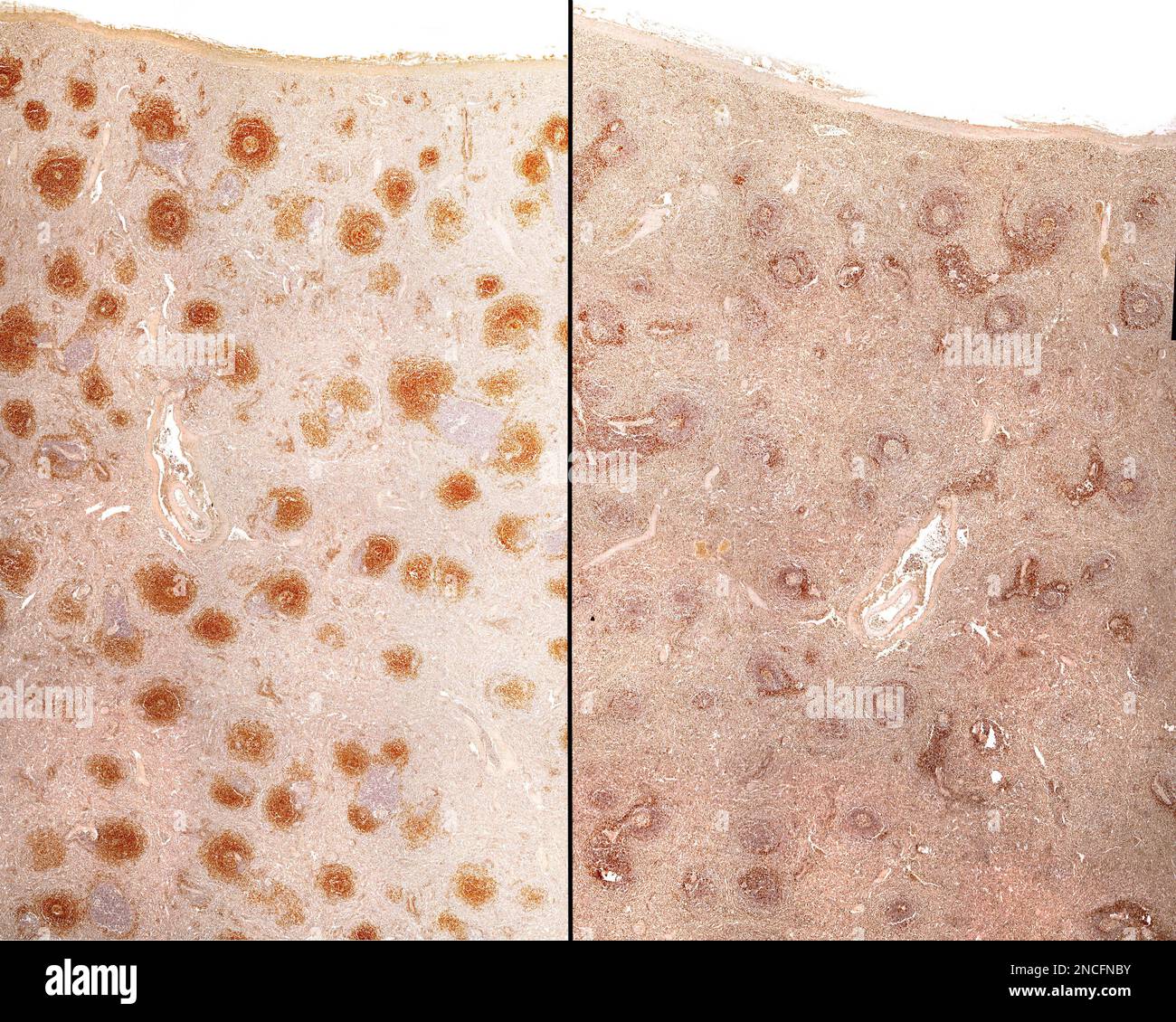 Human spleen, light micrograph Stock Photo - Alamy