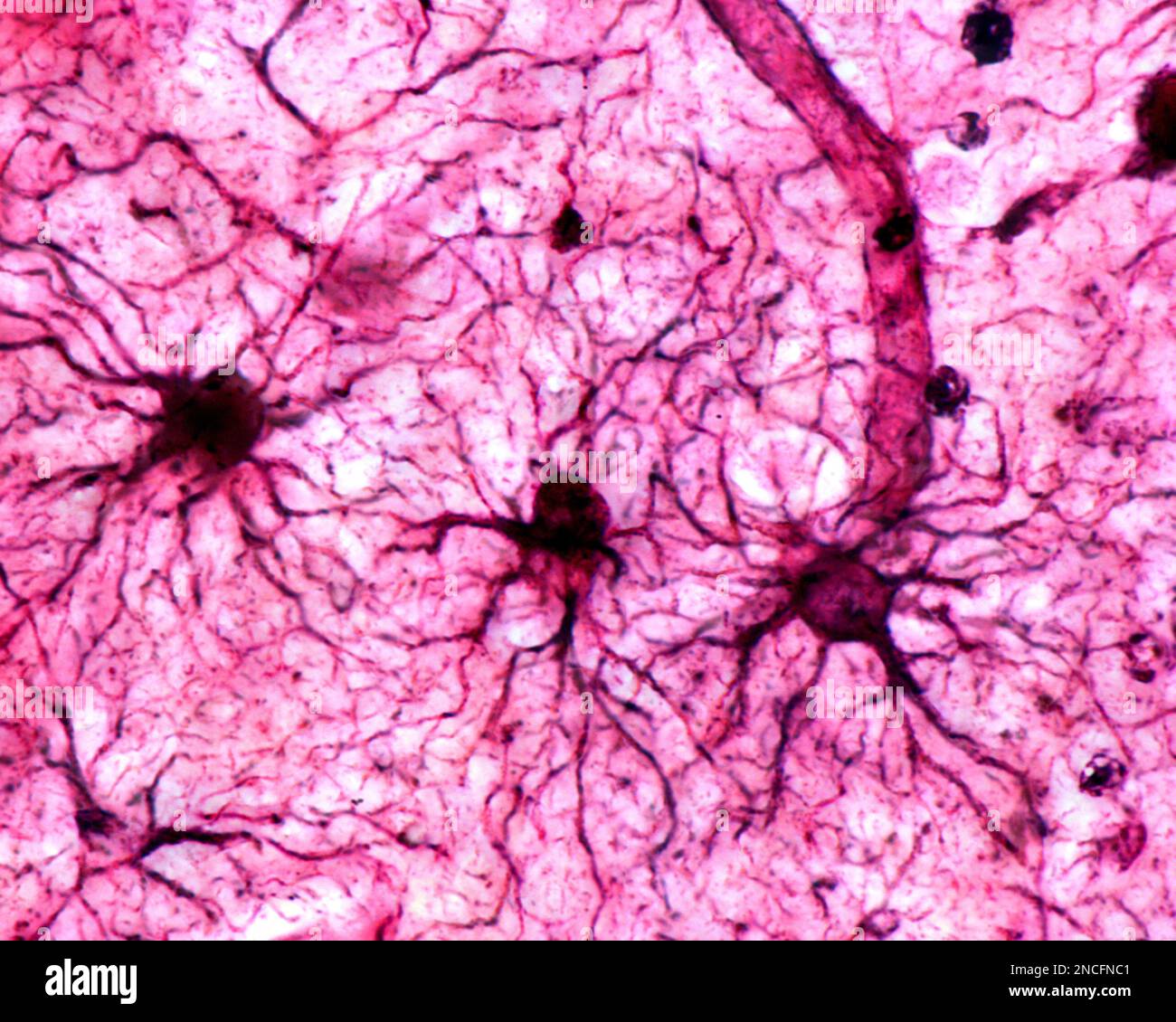 Astrocyte, light micrograph Stock Photo - Alamy