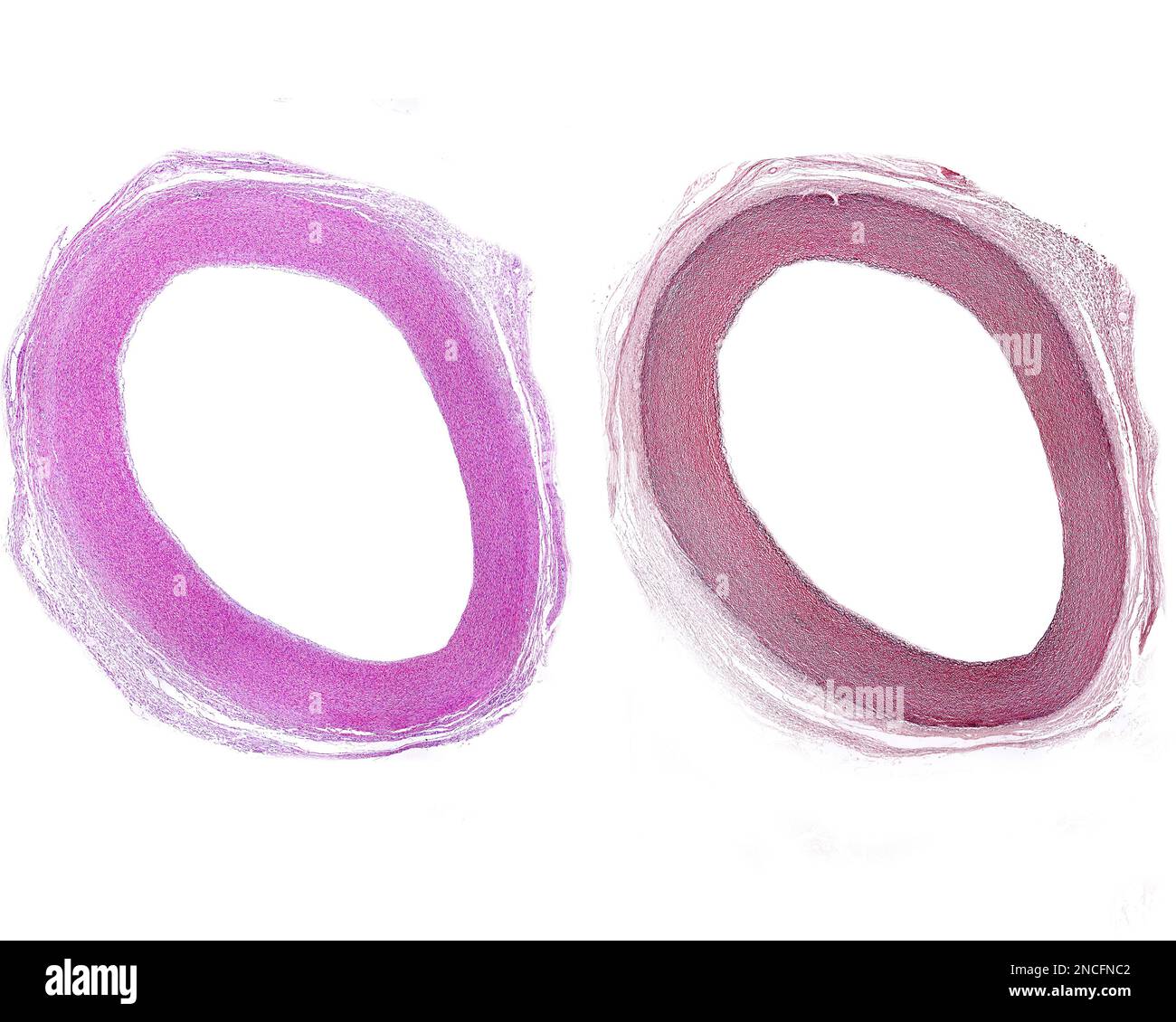 Elastic arteries, light micrograph Stock Photo - Alamy