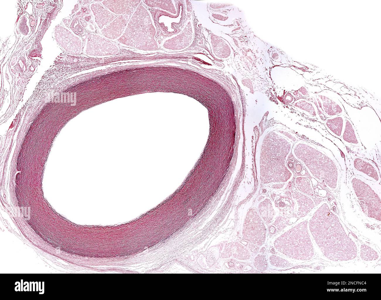 Elastic artery, light micrograph Stock Photo - Alamy