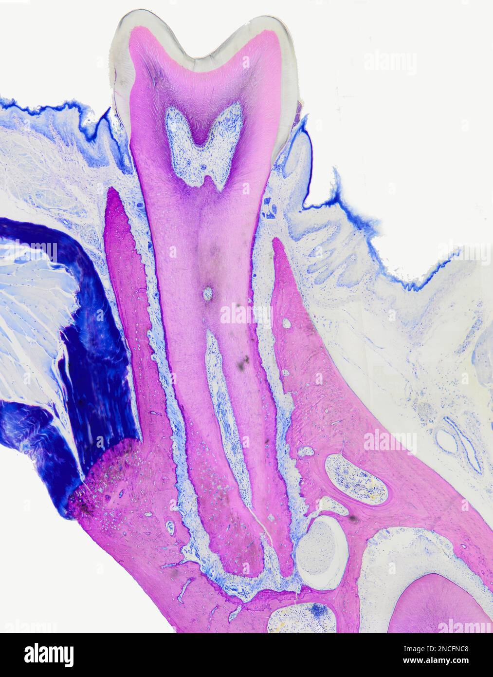 Mouse tooth, light micrograph Stock Photo - Alamy