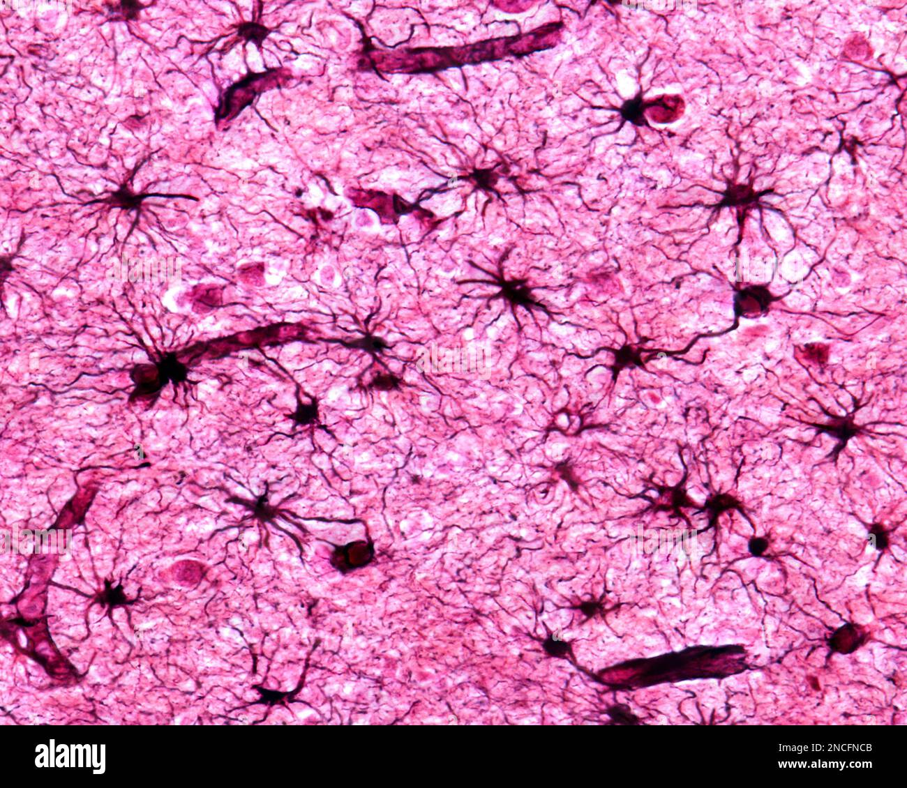 Protoplasmic astrocytes, light micrograph Stock Photo - Alamy