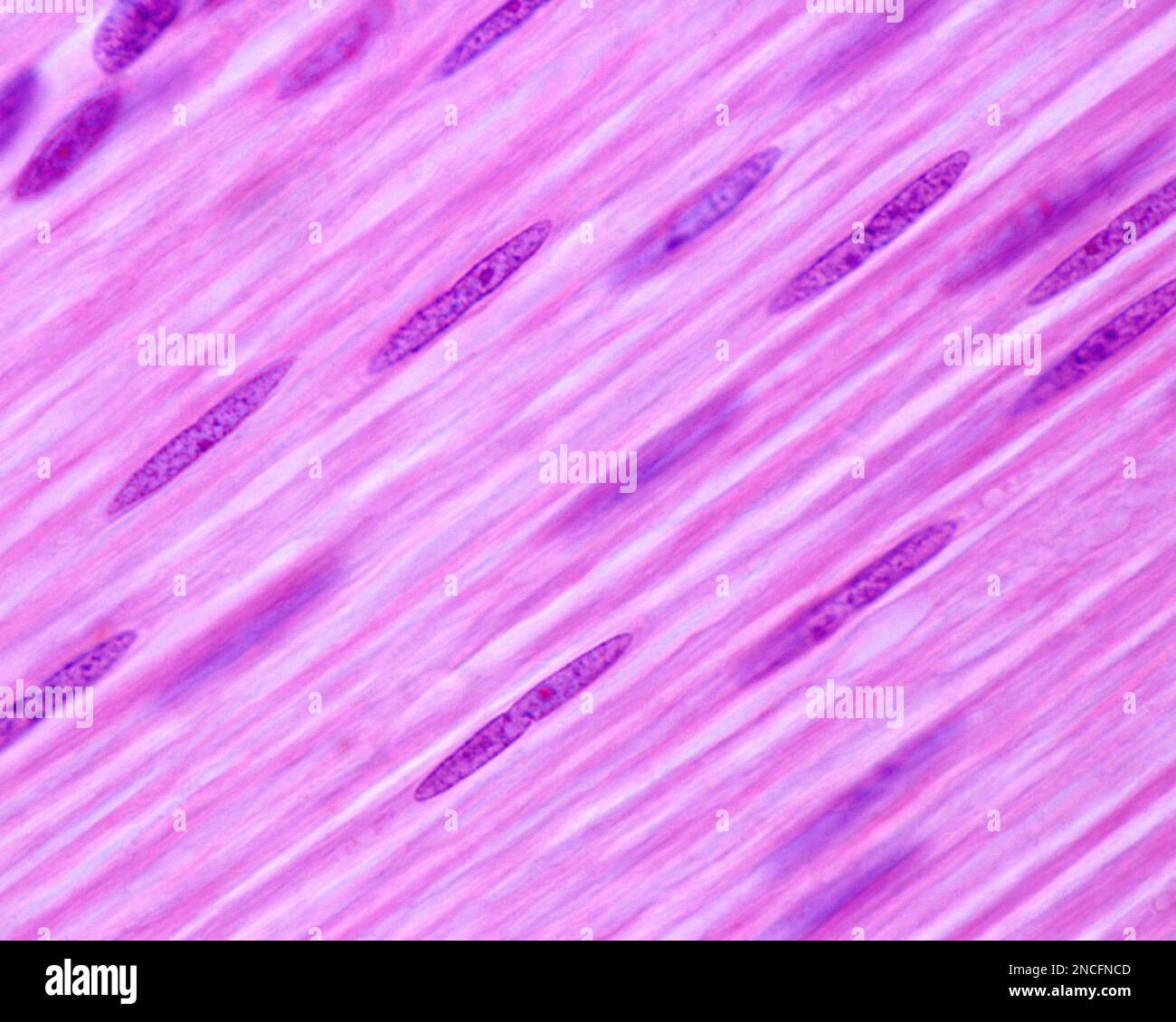 Smooth muscle fibres, light micrograph Stock Photo - Alamy