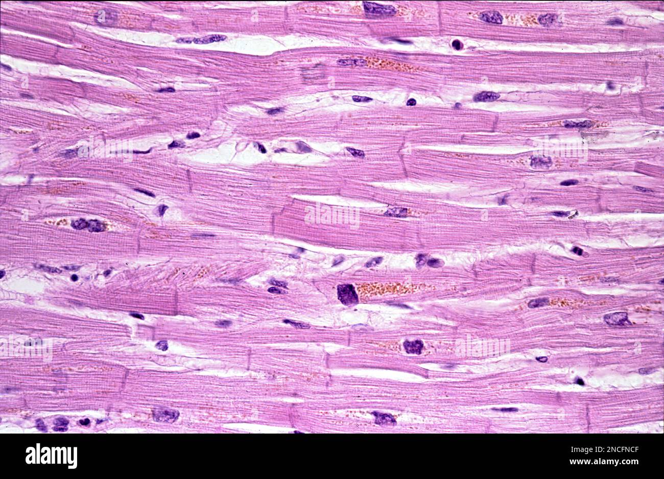 Human heart myocardium, light micrograph Stock Photo - Alamy