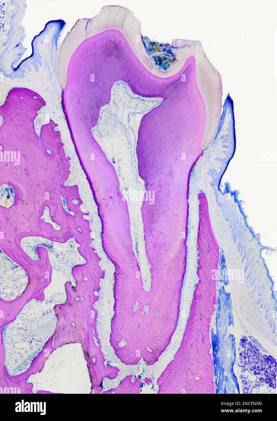 Rat tooth, light micrograph Stock Photo - Alamy