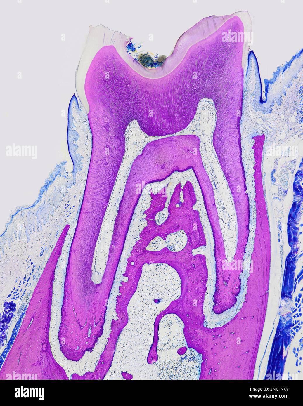 Rat tooth, light micrograph Stock Photo - Alamy