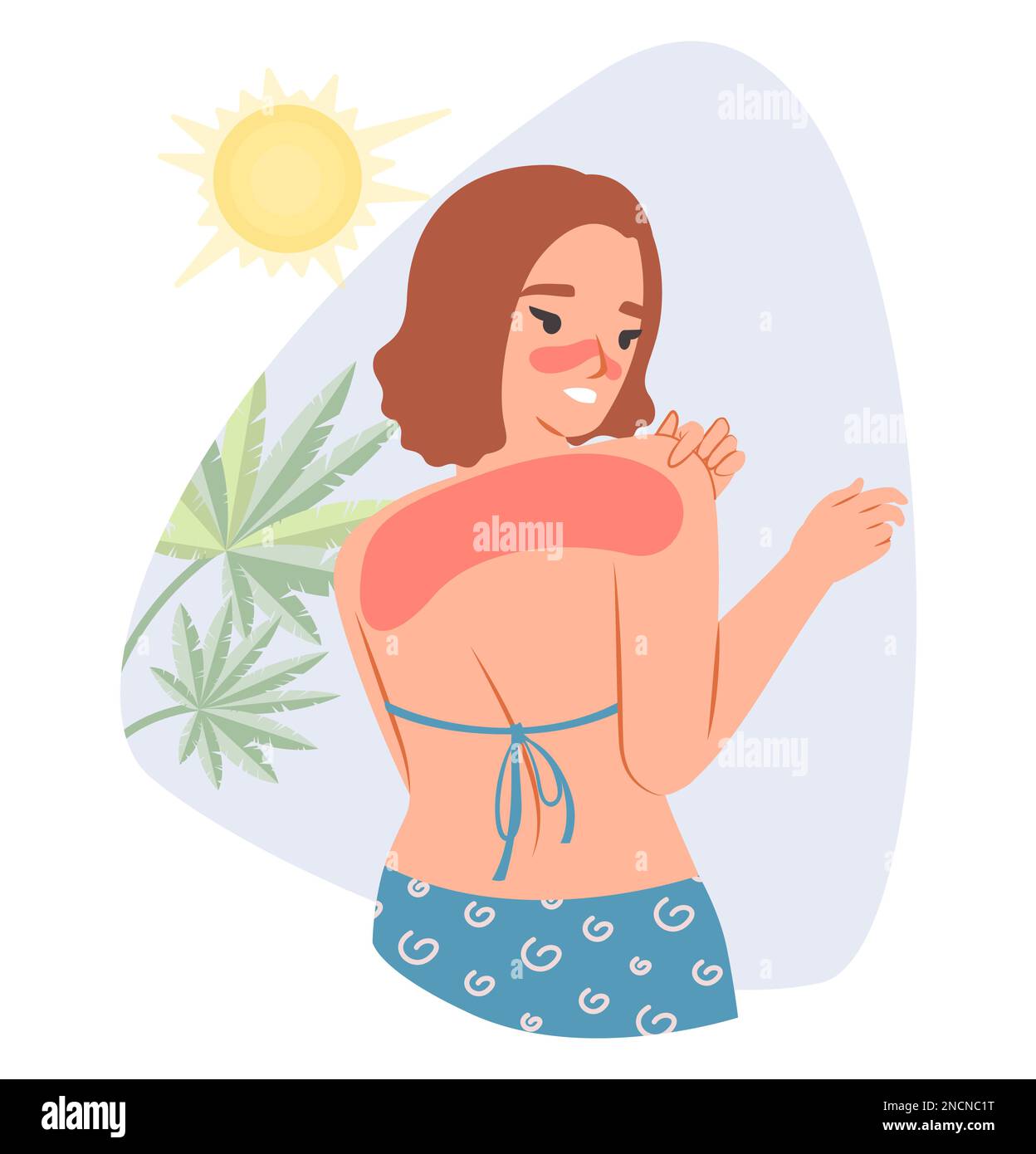 Sunburn Vector Young Woman Caring Redness Shoulder Stock Vector Image